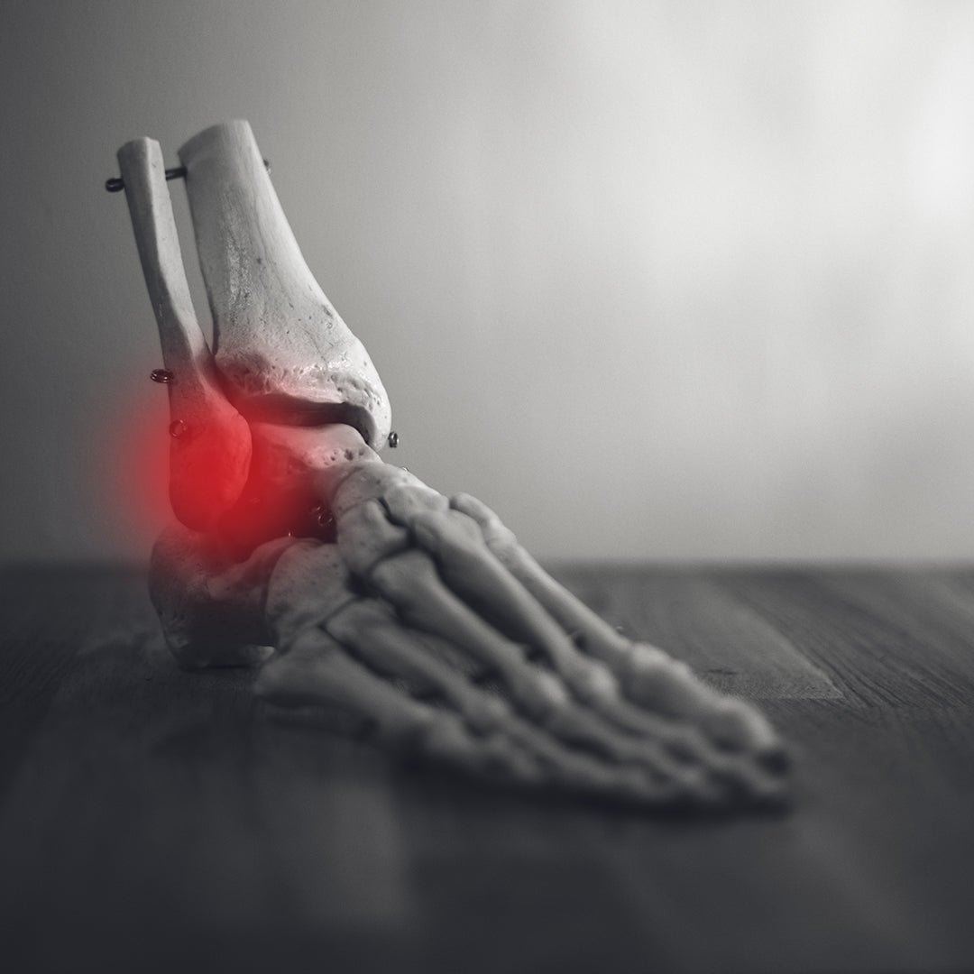 Tips And Stretches For Treating A Rolled Ankle – Remind Insoles